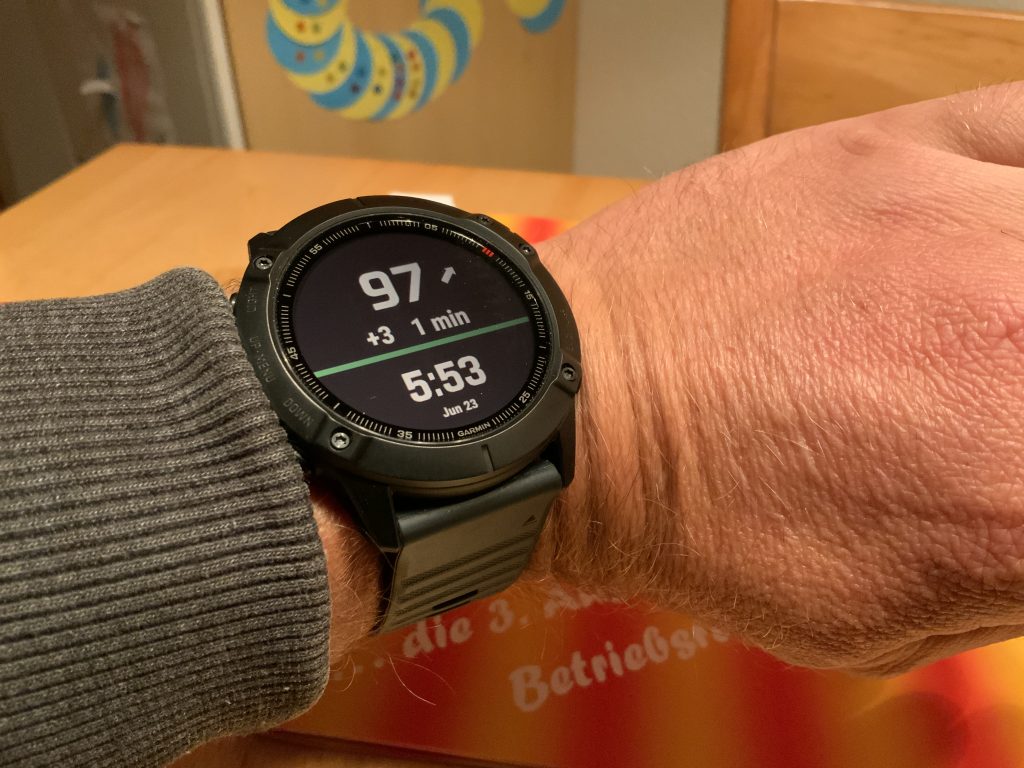 Dexcom G6 beim Sport in Verbindung mit einer Smartwatch – sugarrunner